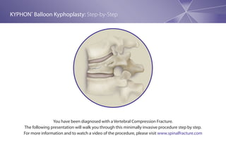 Balloon Kyphoplasty Step By Step Procedure Guide | PDF
