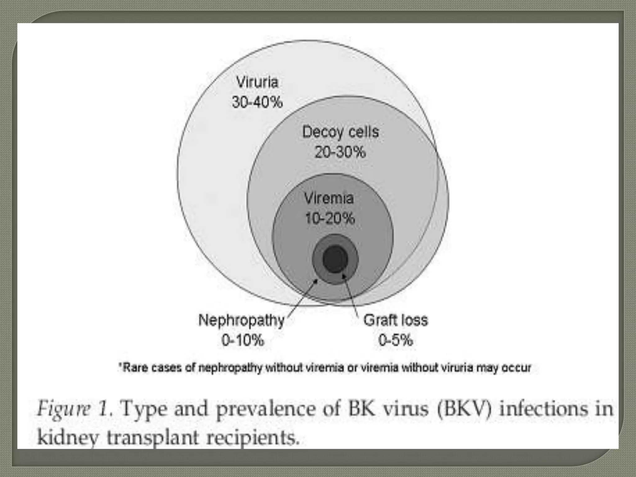 Bk virus nephropathy | PPTX