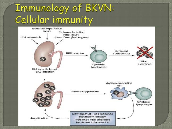 Bk virus nephropathy