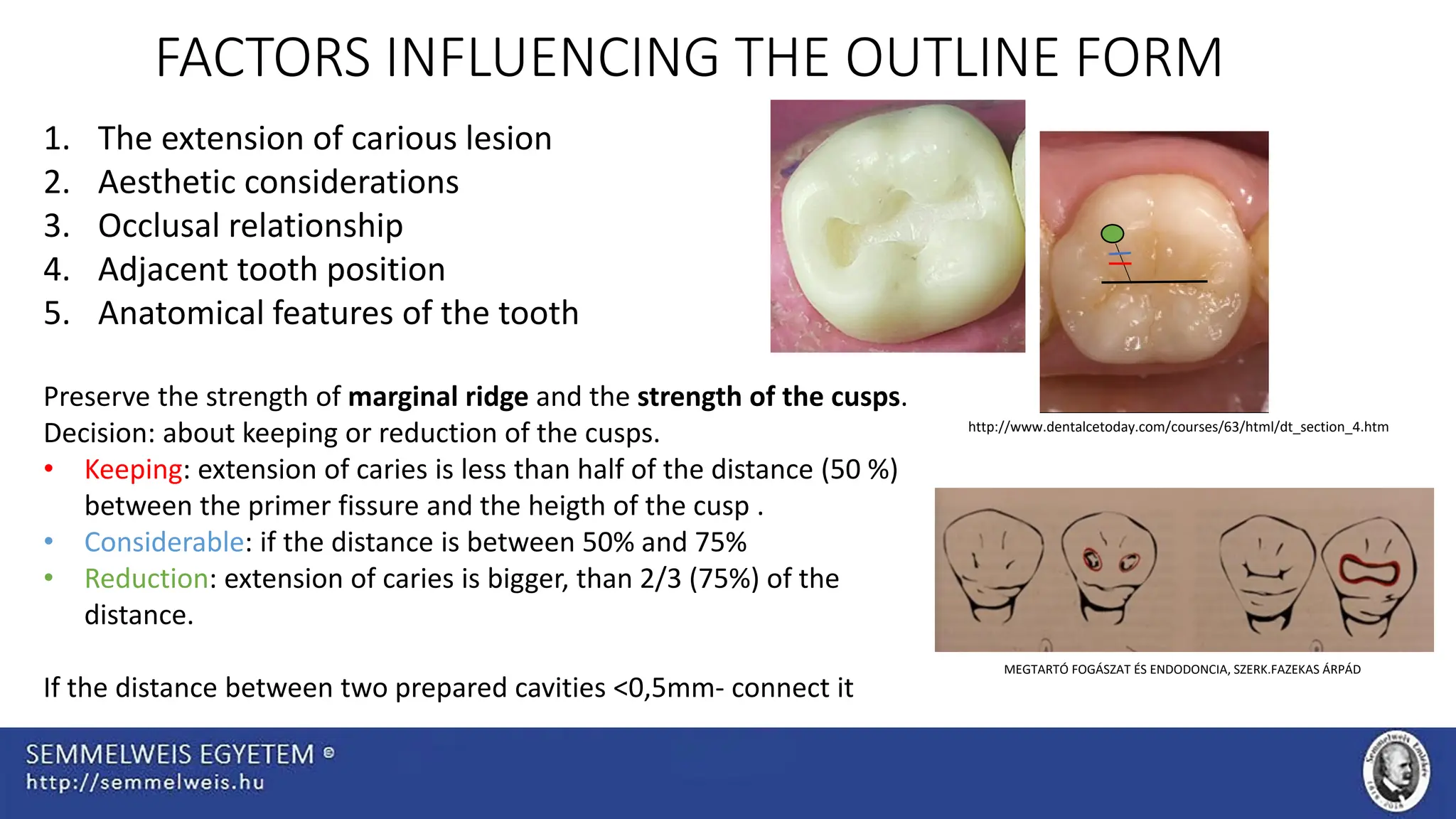 Blacks cavity classification for pit and fissure caries.pdf
