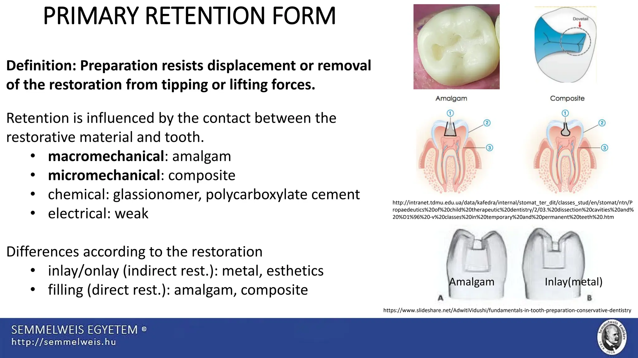 Blacks cavity classification for pit and fissure caries.pdf