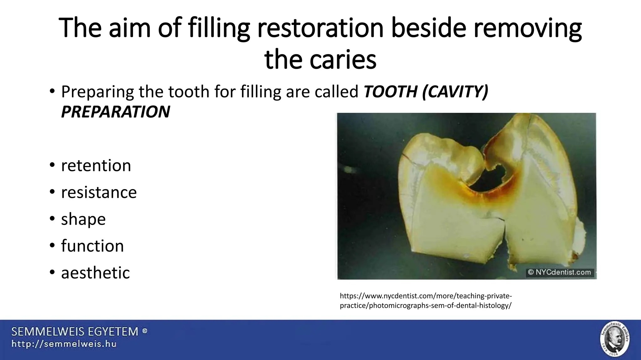 Blacks cavity classification for pit and fissure caries.pdf