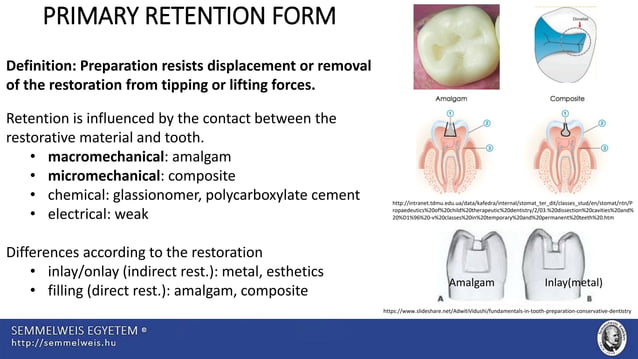 Blacks cavity classification for pit and fissure caries.pdf