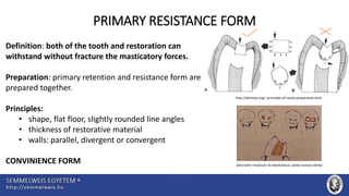 Blacks cavity classification for pit and fissure caries.pdf
