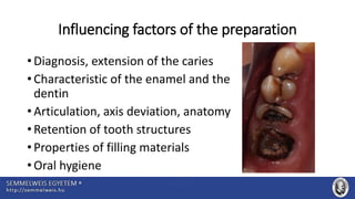 Blacks cavity classification for pit and fissure caries.pdf