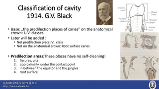 Blacks cavity classification for pit and fissure caries.pdf