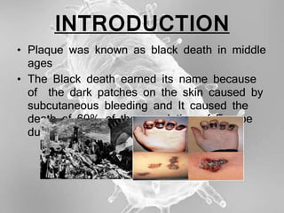 Black death | PPTX