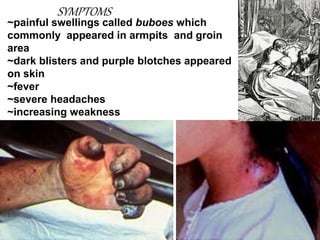 BlackDeath_002.ppt | Infectious Diseases | Diseases and Conditions