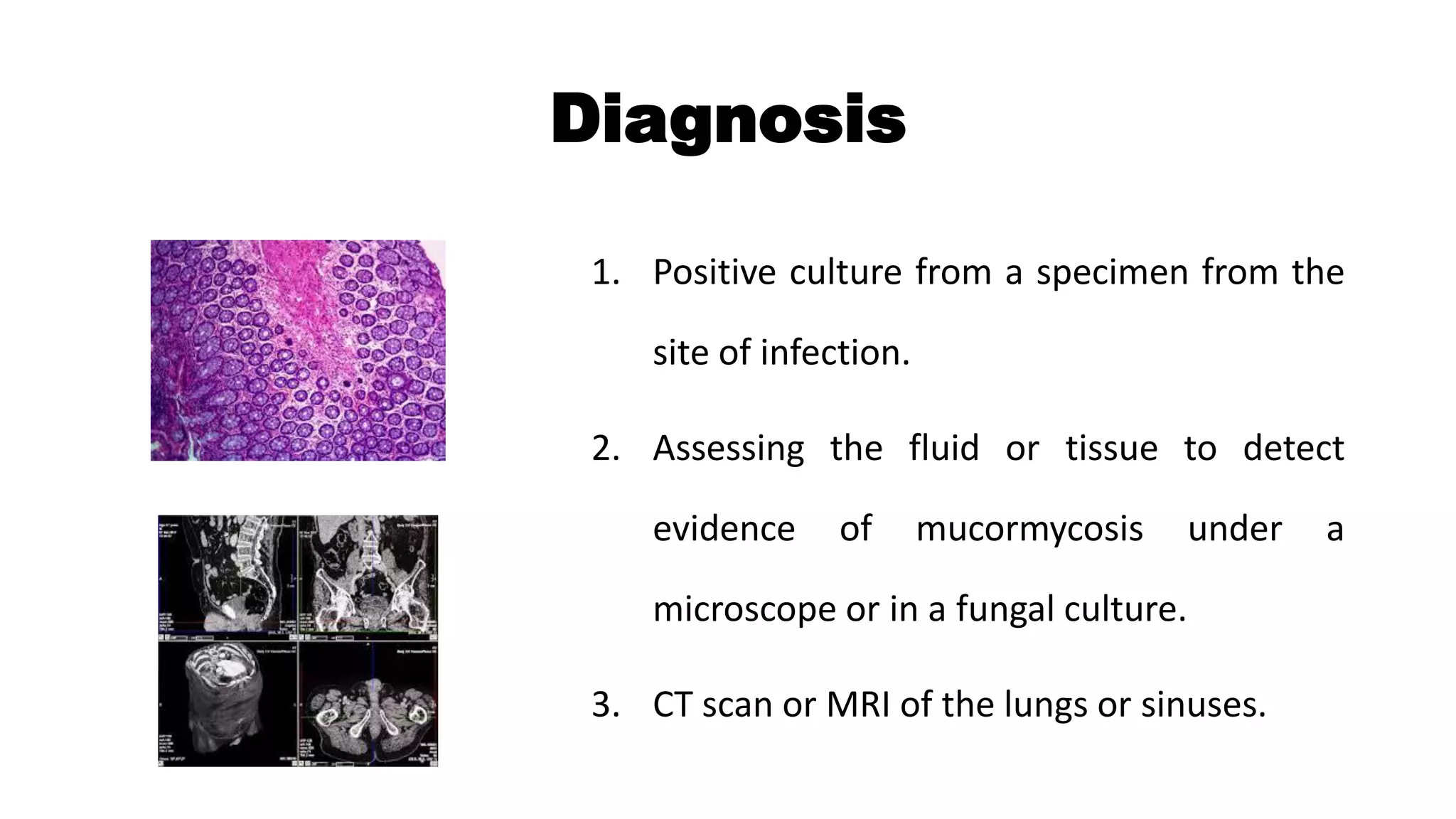 Black fungus #mucormycosis #cutaneous (skin) mucormycosis # ...