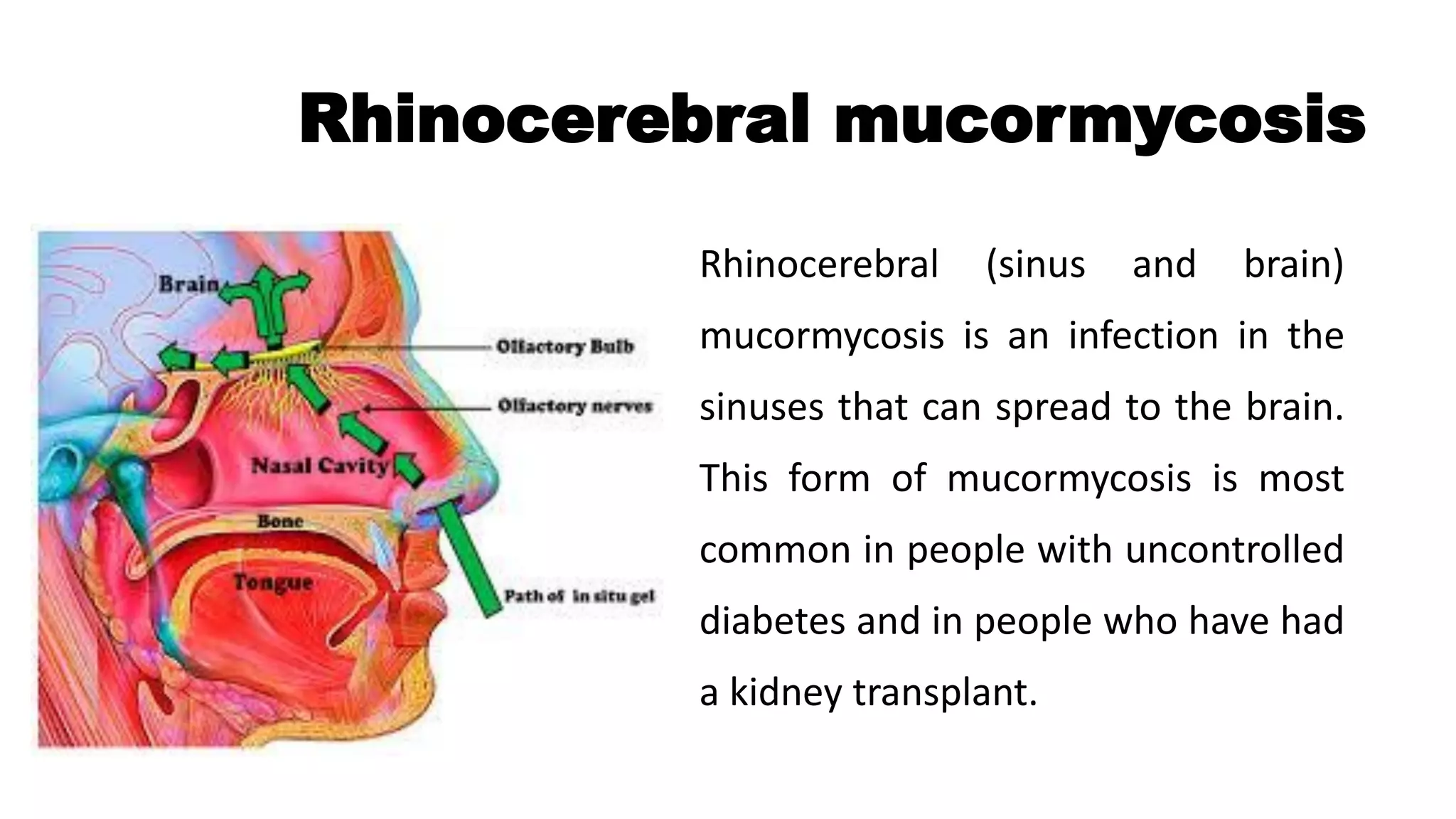 Black fungus #mucormycosis #cutaneous (skin) mucormycosis # ...