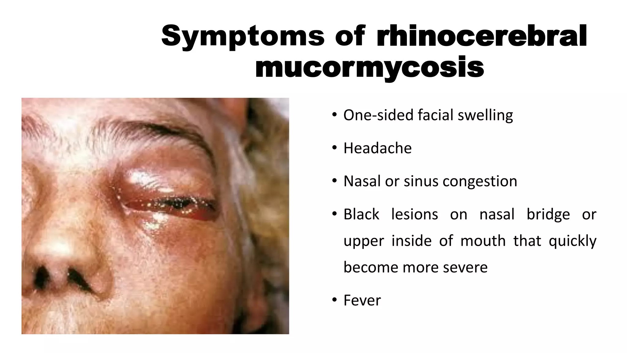 Black fungus #mucormycosis #cutaneous (skin) mucormycosis # ...
