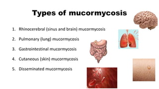 Gastrointestinal Mucormycosis