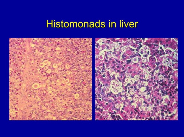 Blackhead histomoniasis in turkey and.ppt