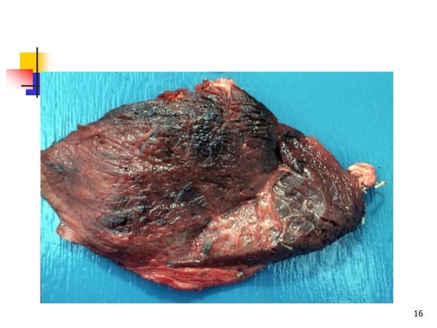 Blackleg (black quarter)