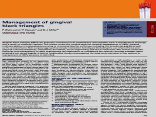 Black triangle Management Journal Presentation | PPTX