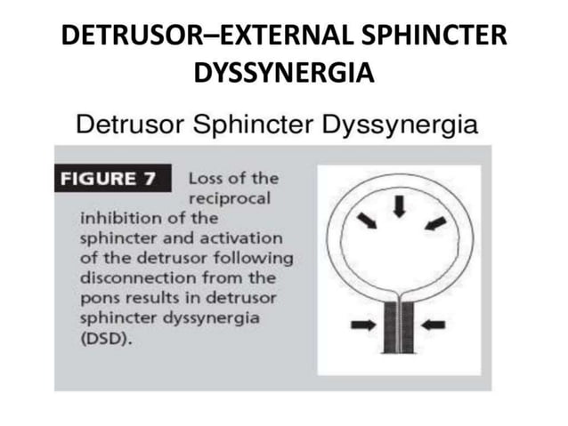 Bladder - UMN Versus LMN bladder | PPTX