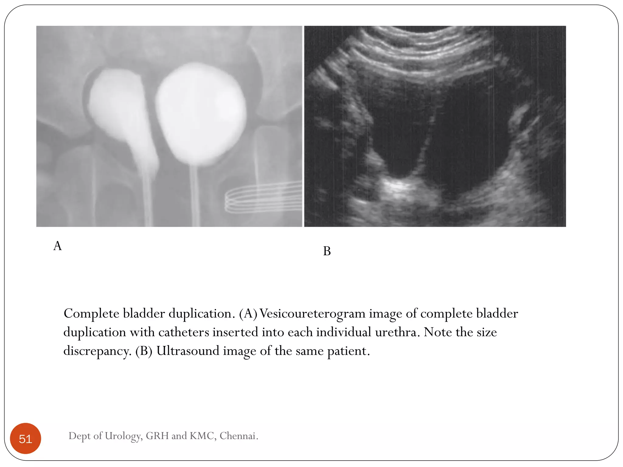 Bladder anatomy & embryology of bladder and urethra-converted | PDF