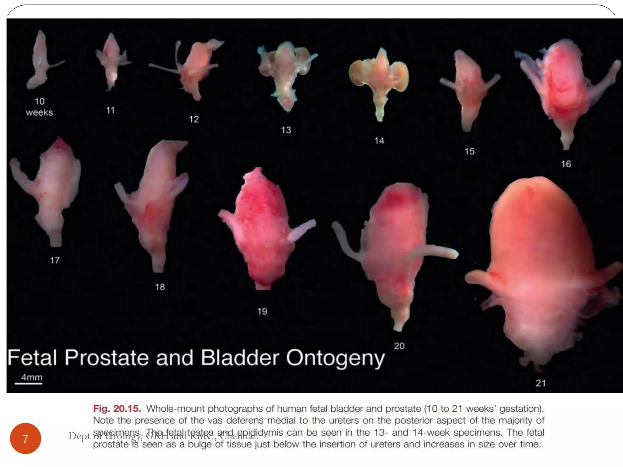 Bladder anatomy & embryology of bladder and urethra-converted | PDF