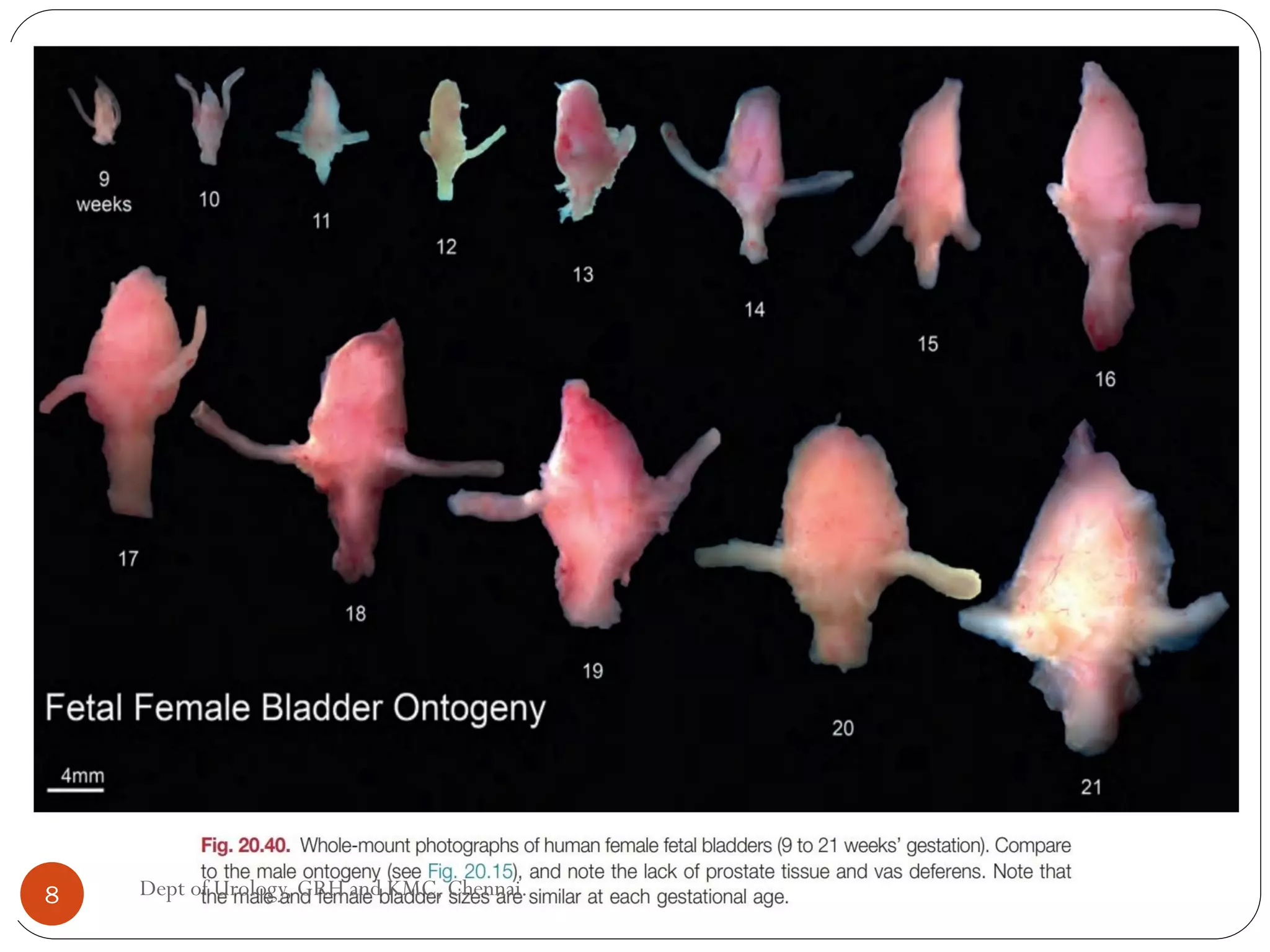 Bladder anatomy & embryology of bladder and urethra-converted | PDF