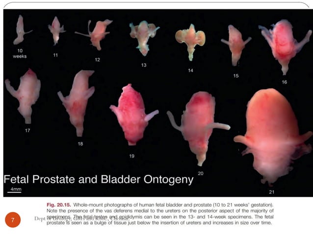 Bladder anatomy & embryology of bladder and urethra-converted | PDF