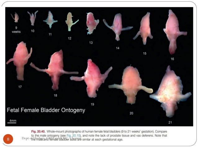 Bladder anatomy & embryology of bladder and urethra-converted | PDF