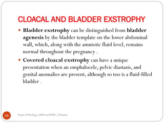 Bladder Exstrophy Embryology