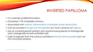 Benign Urinary Bladder Tumors | PDF