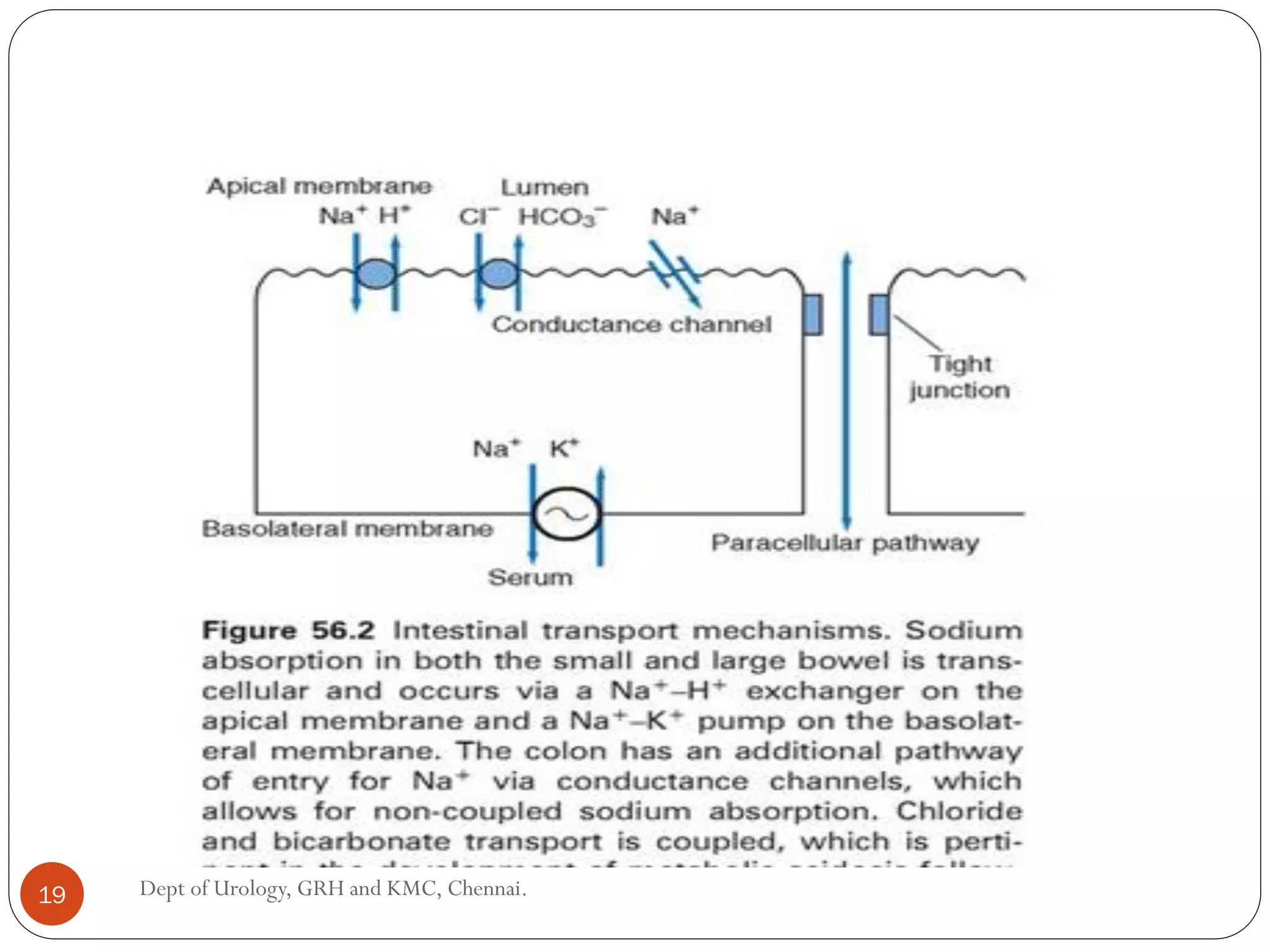 Bladder carcinoma- augmentation cystoplasty complications | PDF