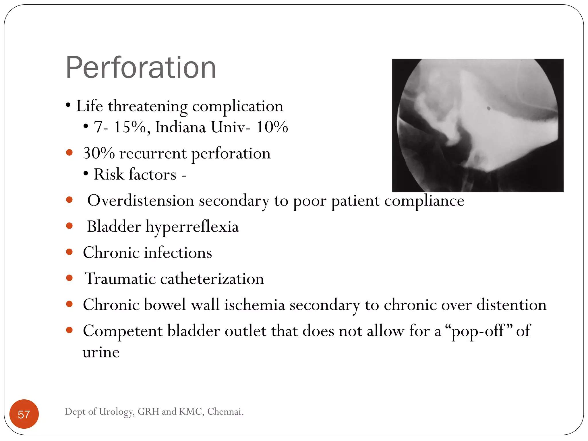Bladder carcinoma- augmentation cystoplasty complications | PDF