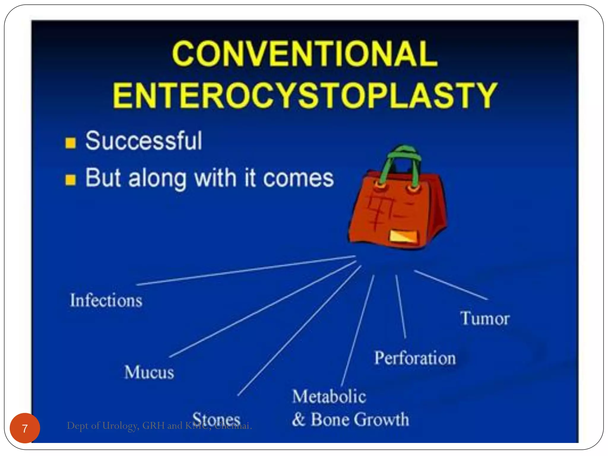 Bladder carcinoma- augmentation cystoplasty complications | PDF