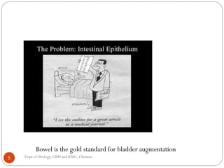 Bladder carcinoma- augmentation cystoplasty complications | PDF