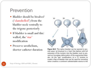 Bladder carcinoma- augmentation cystoplasty complications | PDF