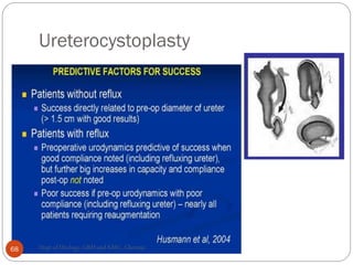 Bladder carcinoma- augmentation cystoplasty complications | PDF