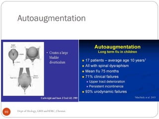 Bladder carcinoma- augmentation cystoplasty complications | PDF