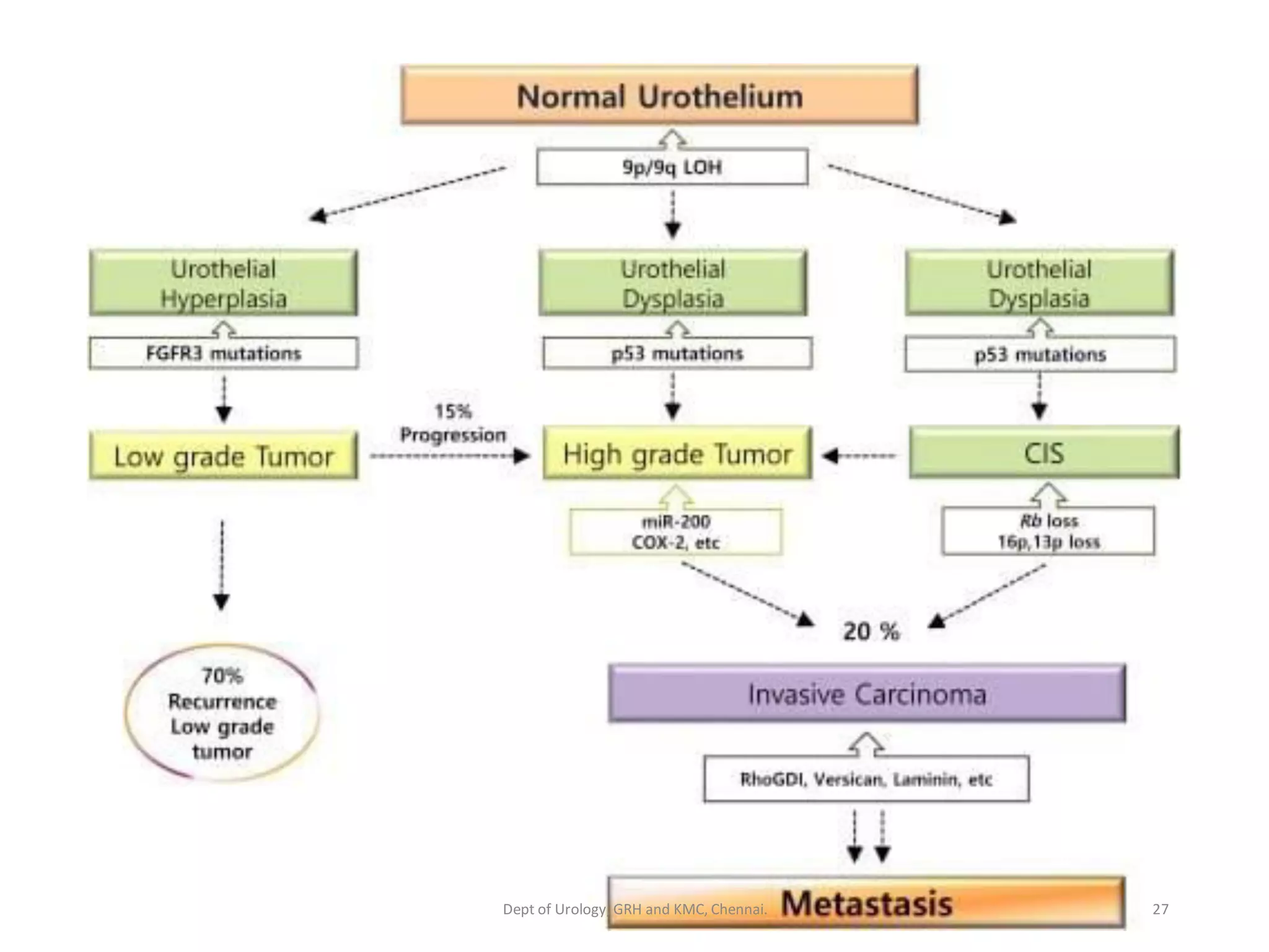 Etiopathogenesis Urinary bladder malignancy | PDF