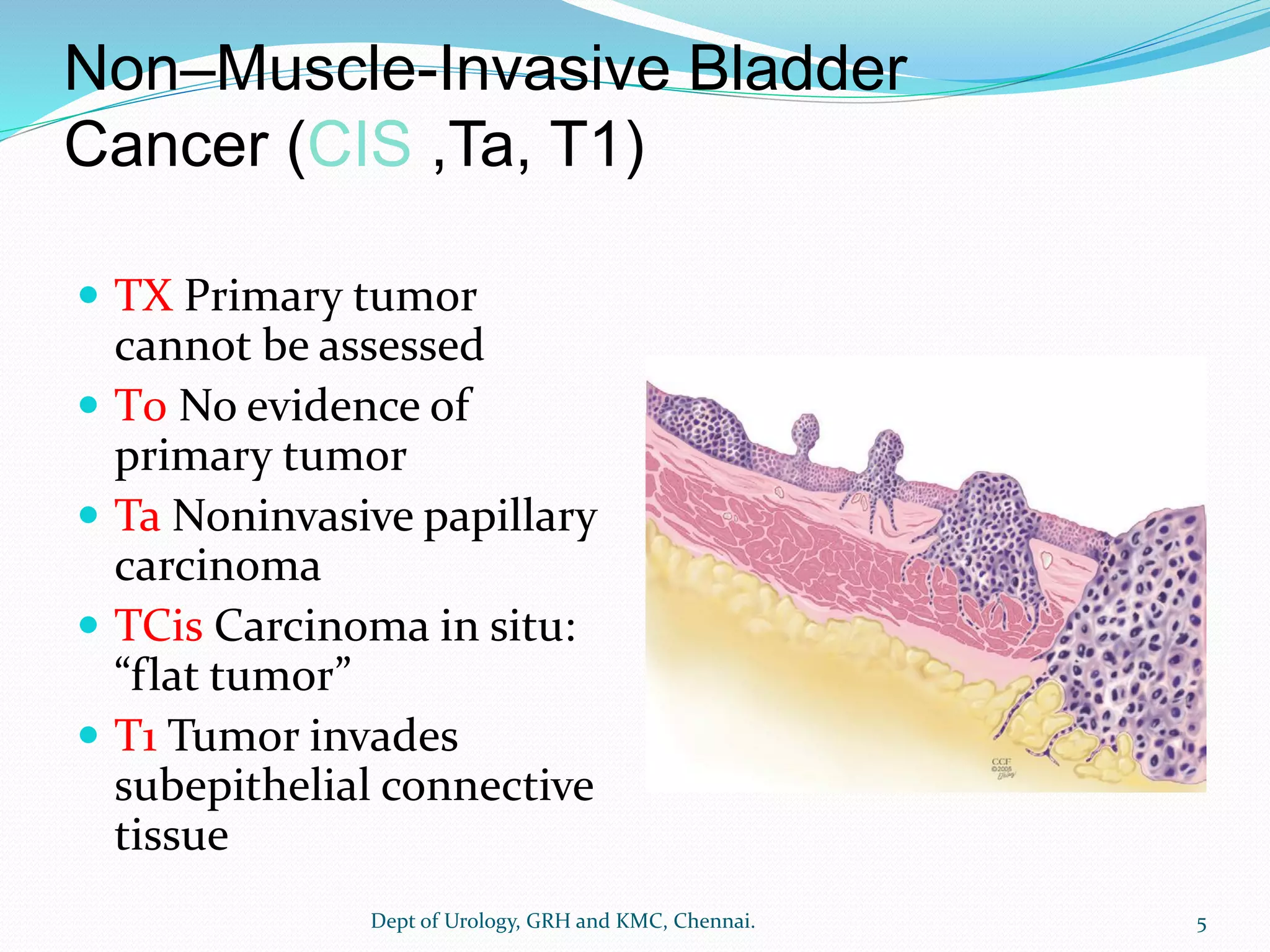 Bladder carcinoma- intravesical therapy | PDF