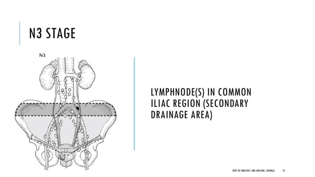 MIBC & Metastatic Urinary Bladder carcinoma | PDF