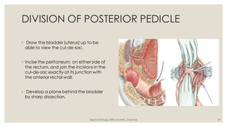 Radical cystectomy | PPT