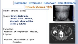 Bladder carcinoma- surgery- urinary diversion | PDF