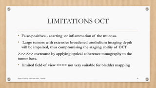 Bladder carcinoma- urinary biomarkers diagnosis and staging | PDF