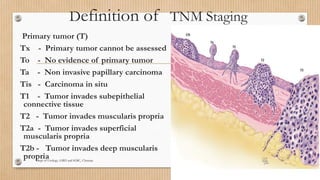 Bladder carcinoma- urinary biomarkers diagnosis and staging | PDF