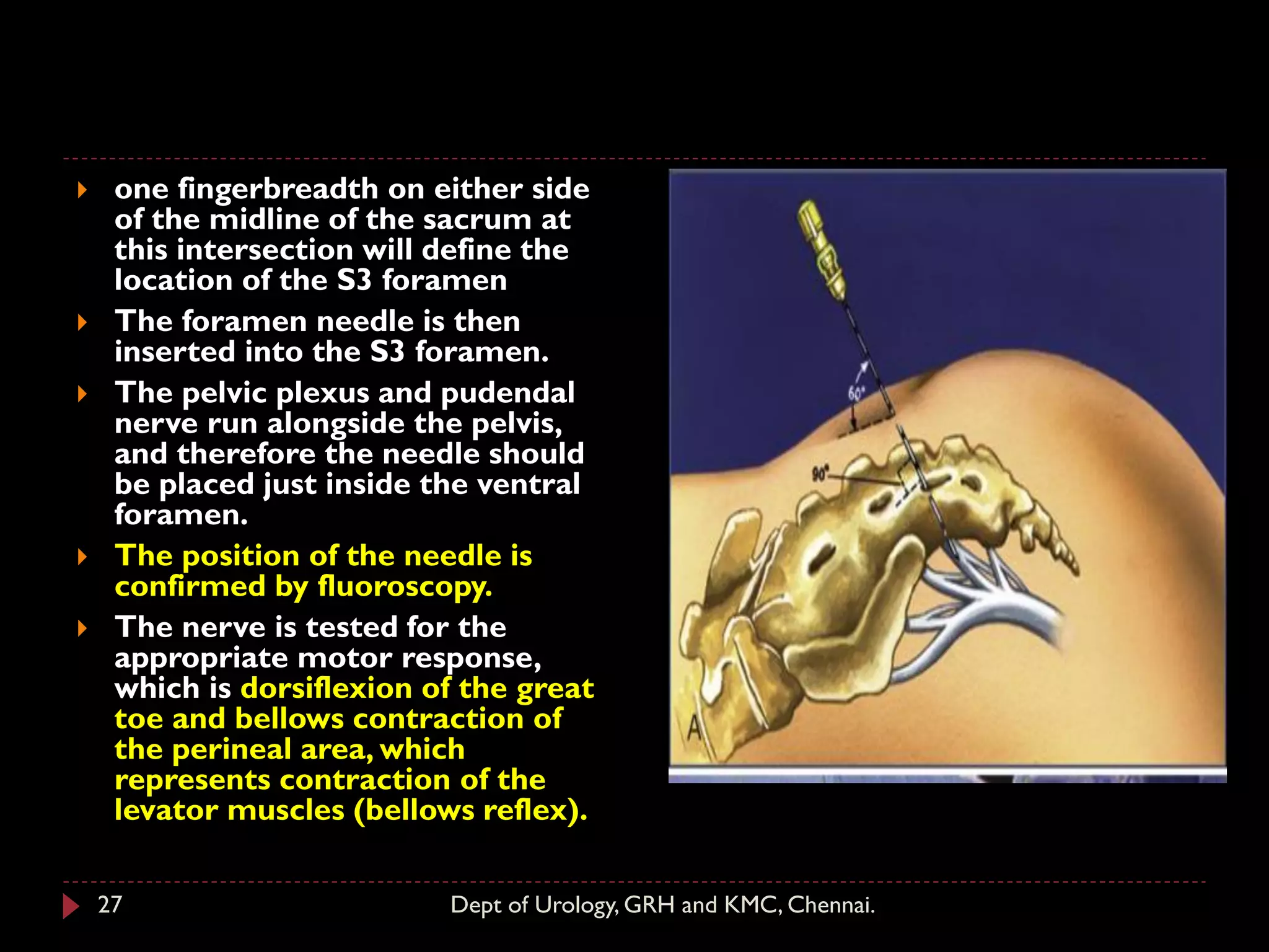 Bladder neurogenic- management- surgical | PDF | Physical Therapy ...