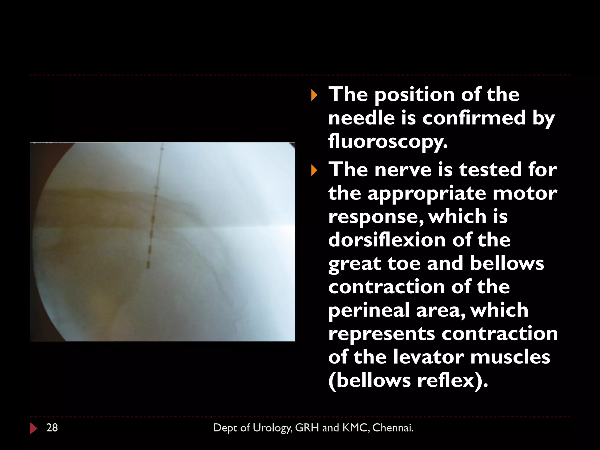 Bladder neurogenic- management- surgical | PDF | Physical Therapy ...