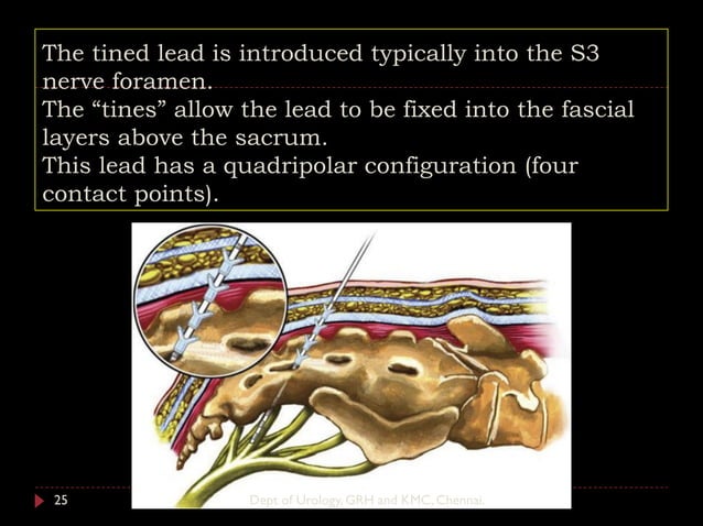 Bladder neurogenic- management- surgical | PDF | Physical Therapy ...