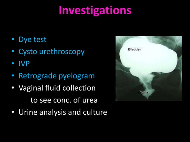 Bladder and injuries | PPTX | Brain and Nervous System Disorders ...