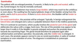 bladder and prostate surgery examination.pptx