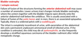 bladder and prostate surgery examination.pptx