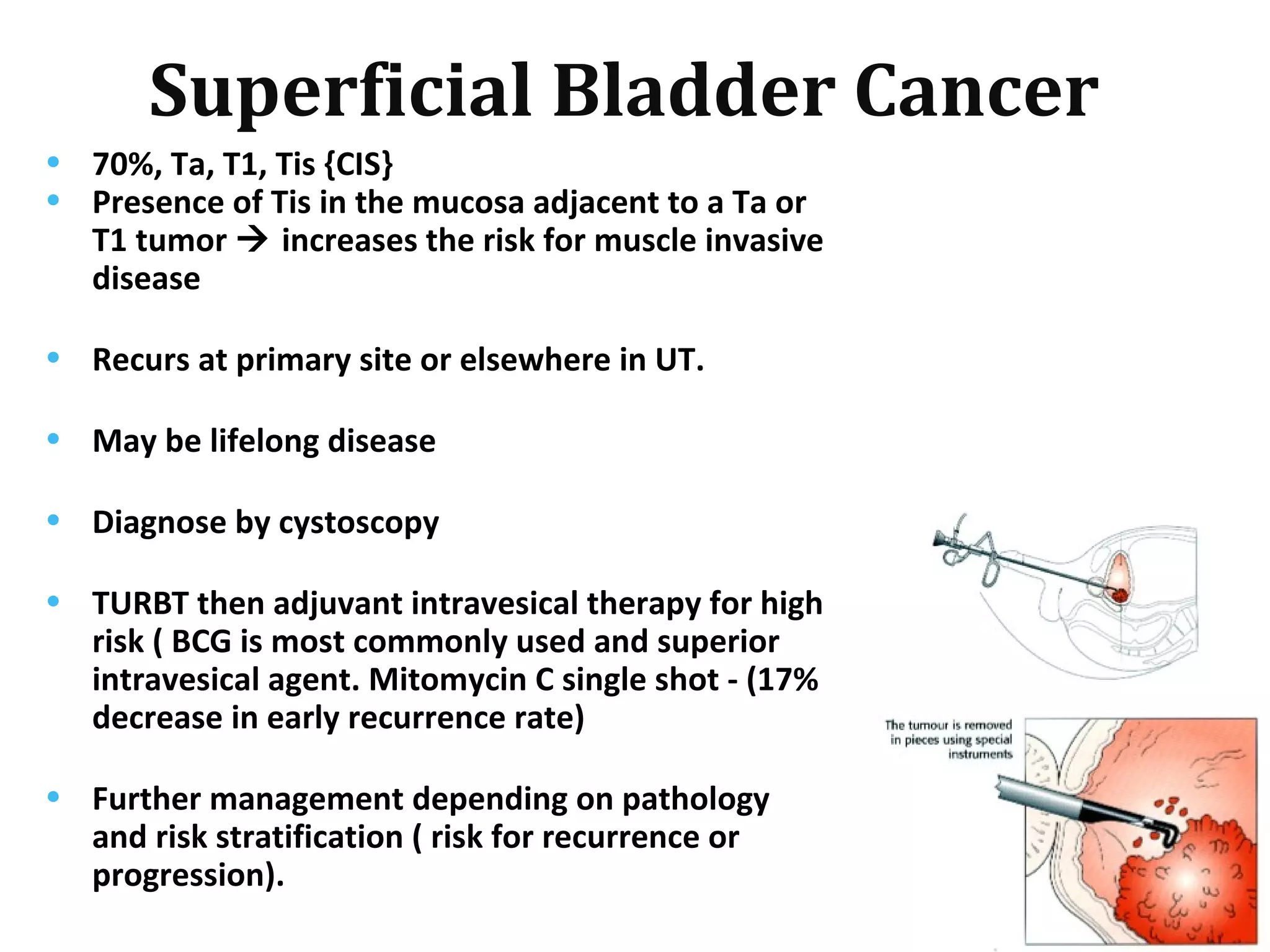 Bladder ca basheer oudah | PPT