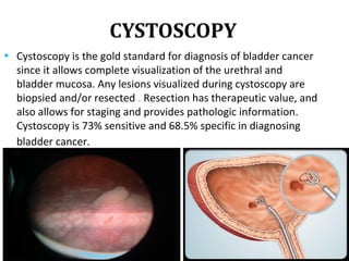 Bladder ca basheer oudah | PPT