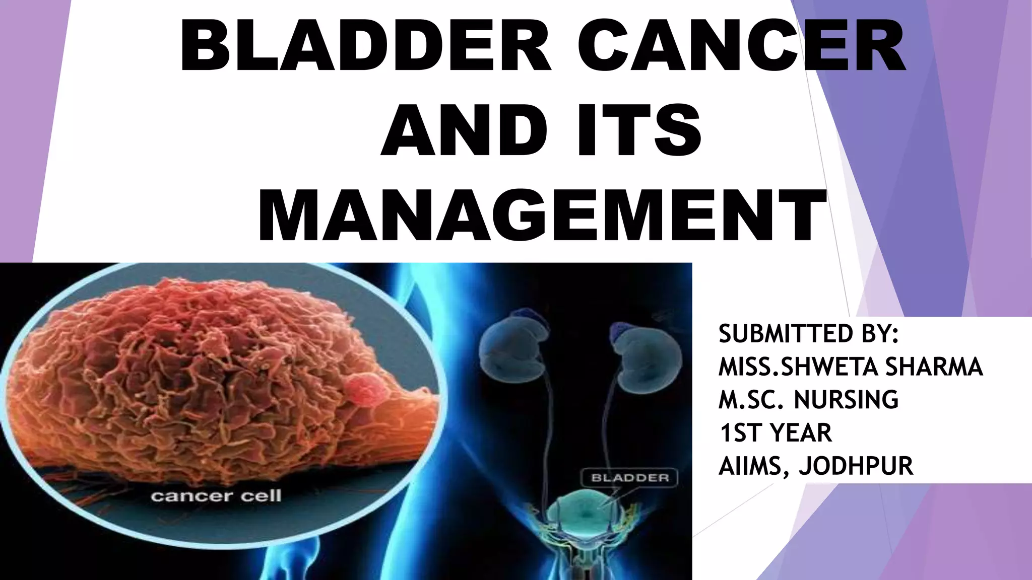 Bladder cancer and its management | PPTX